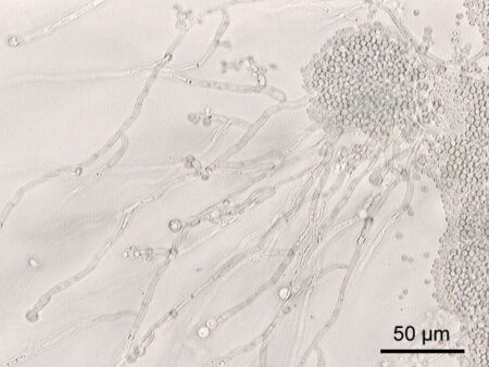 Candida albicans – Ursachen, Symptome & Behandlung